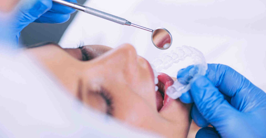 Dentist that accept medi-cal in san diego county – Elite Dentists